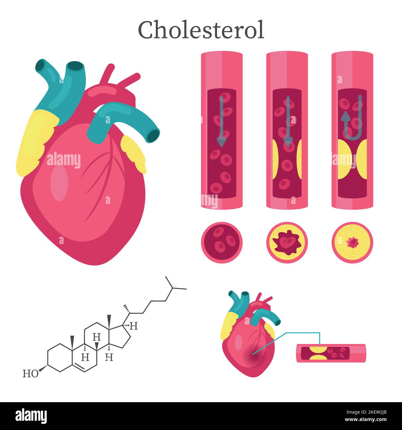 Cholesterol In Artery Cholesterol Molecule Vector Flat Isolated Illustration Negative Health