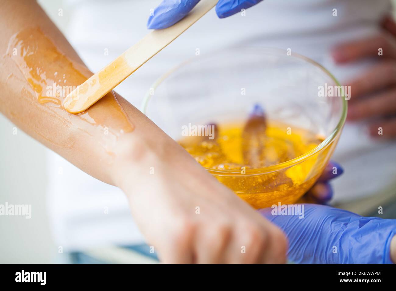 Epilation and depilation with help hi-res stock photography and images ...