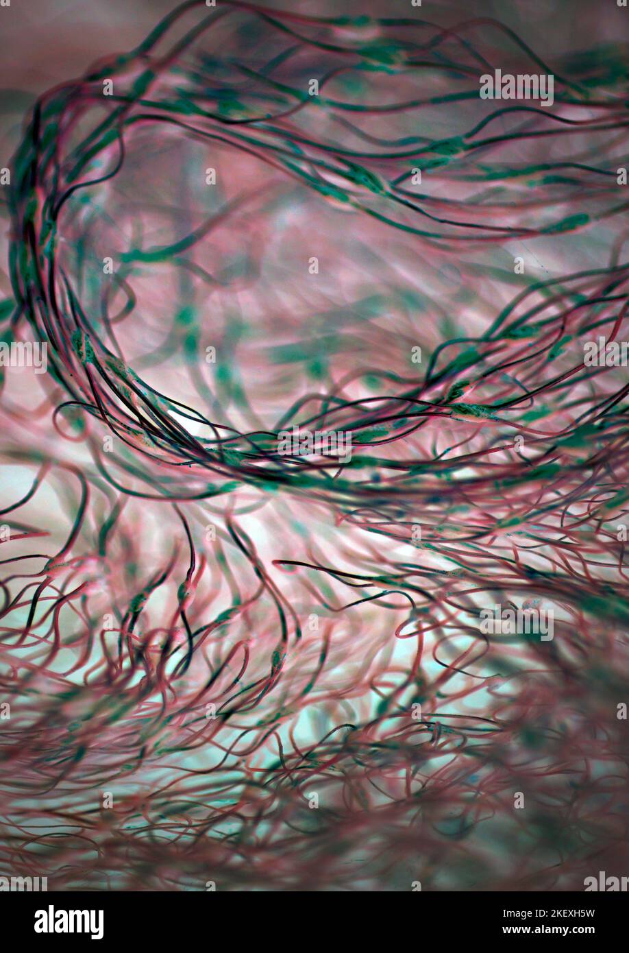 Extruded netting hi-res stock photography and images - Alamy