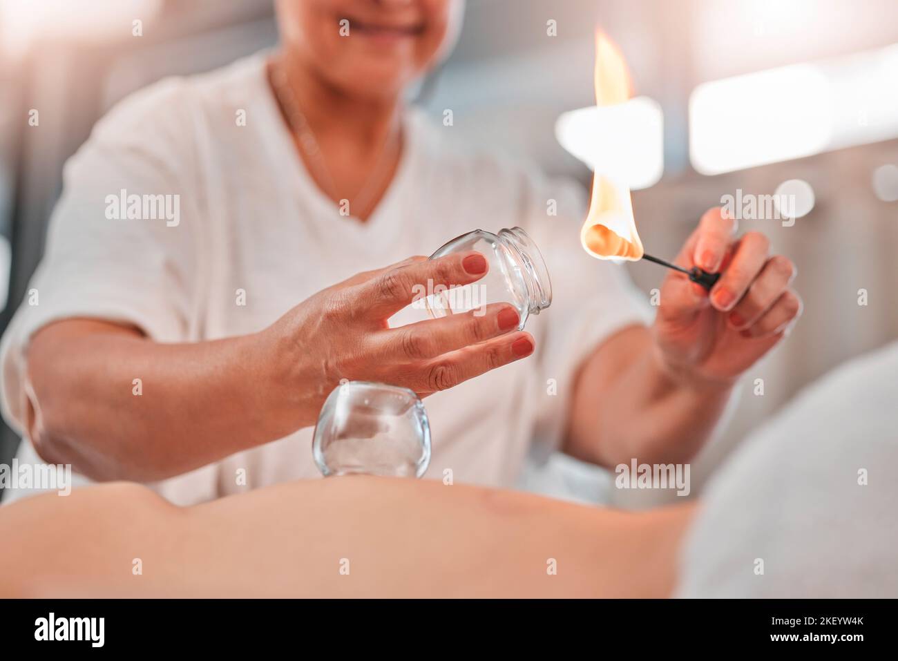 Woman, hands or flame for cupping therapy in spa, hotel salon or ...