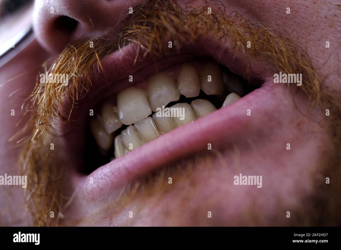 Image of male mouth contorted in rage and anger. Ginger moustache ...