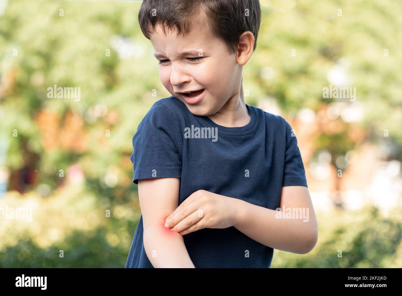 Child scratching arm because it stings in a park with a green ...
