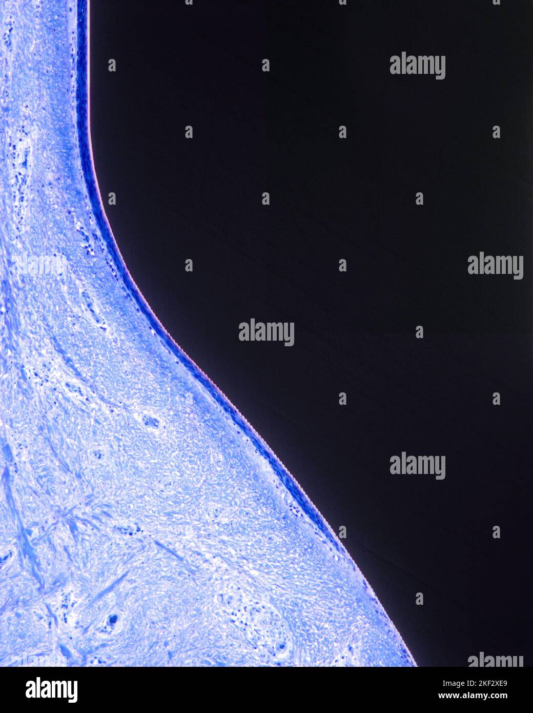 Peri-implant junctional epithelium, light micrograph Stock Photo - Alamy