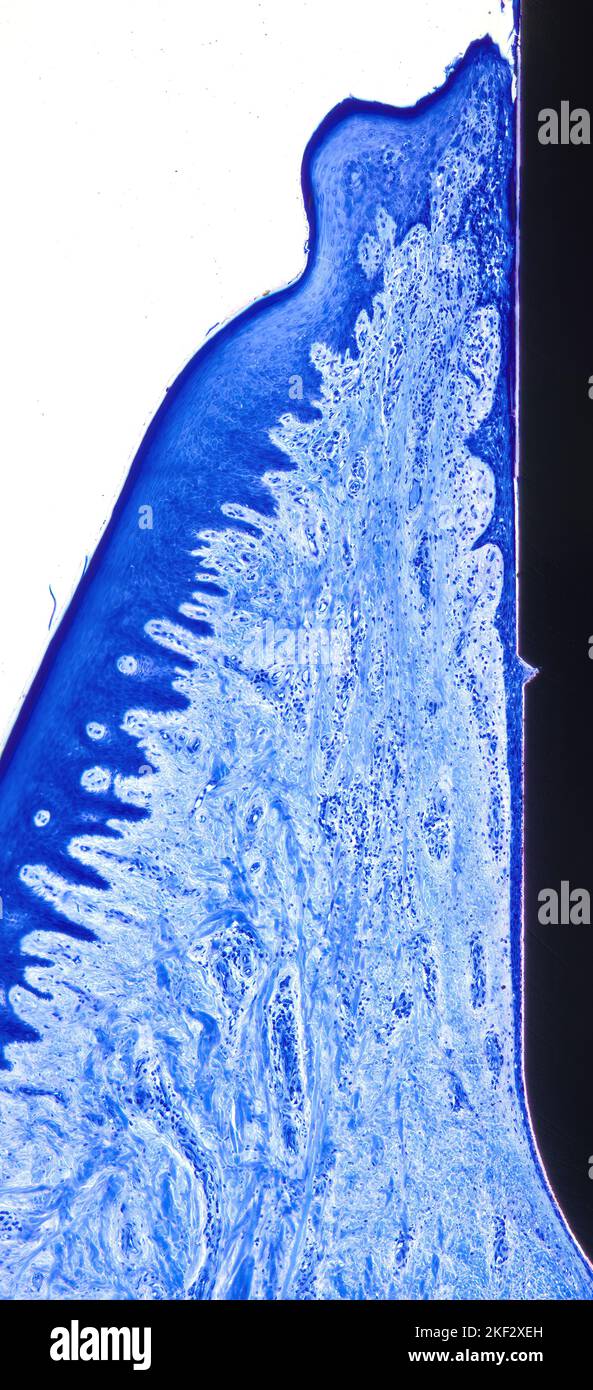 Peri-implant junctional epithelium, light micrograph Stock Photo - Alamy