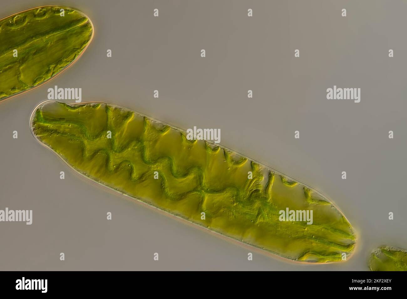 Netrium elongatum - nepalense cf. algae, light micrograph Stock Photo ...