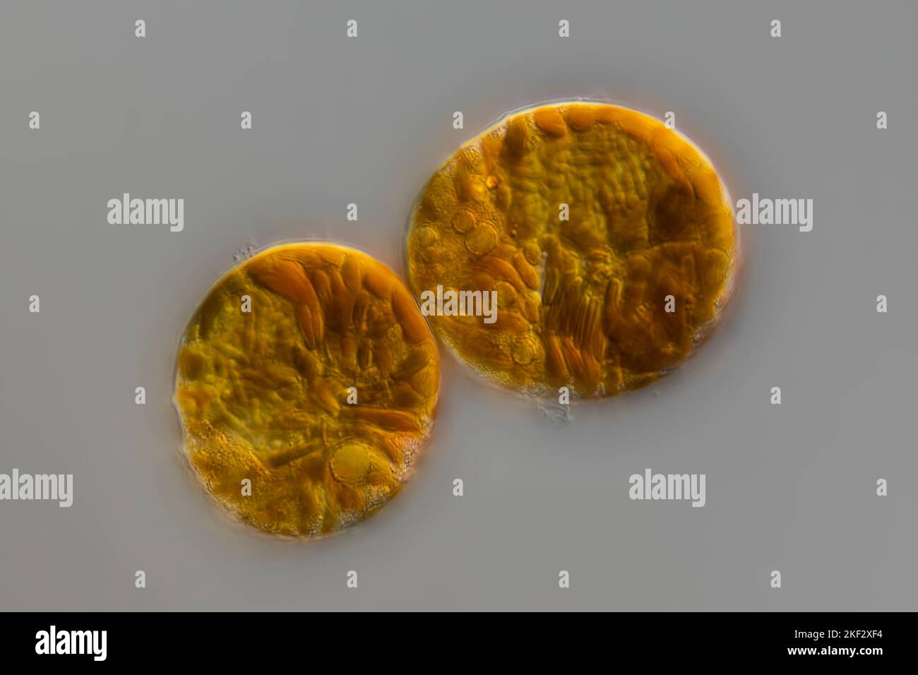 Peridinium centenniale algae, light micrograph Stock Photo - Alamy