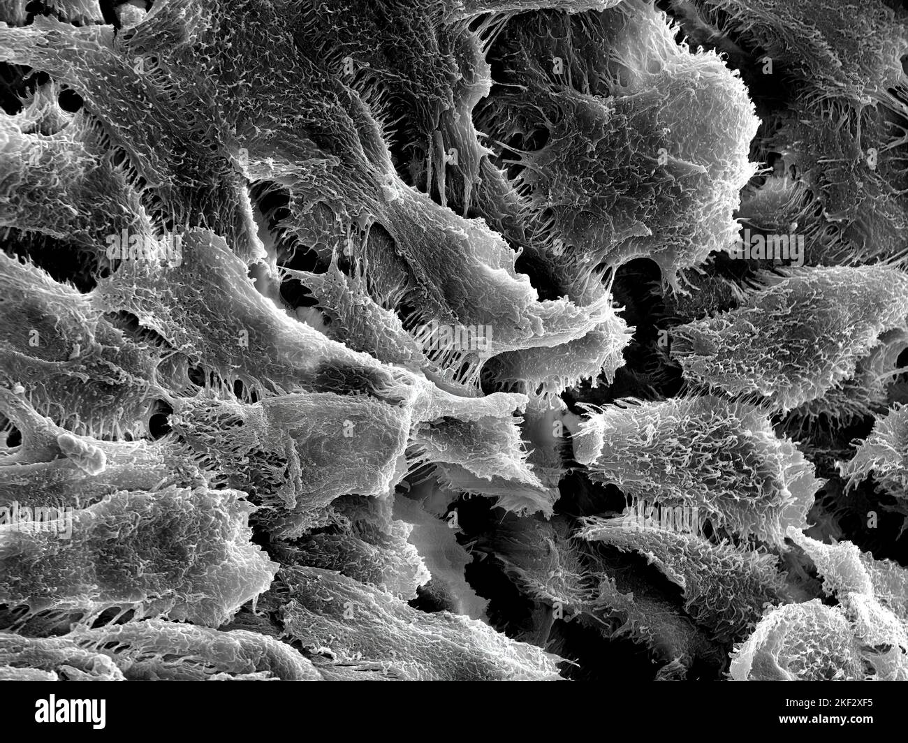 Peri-implant junctional epithelium cells, SEM Stock Photo - Alamy