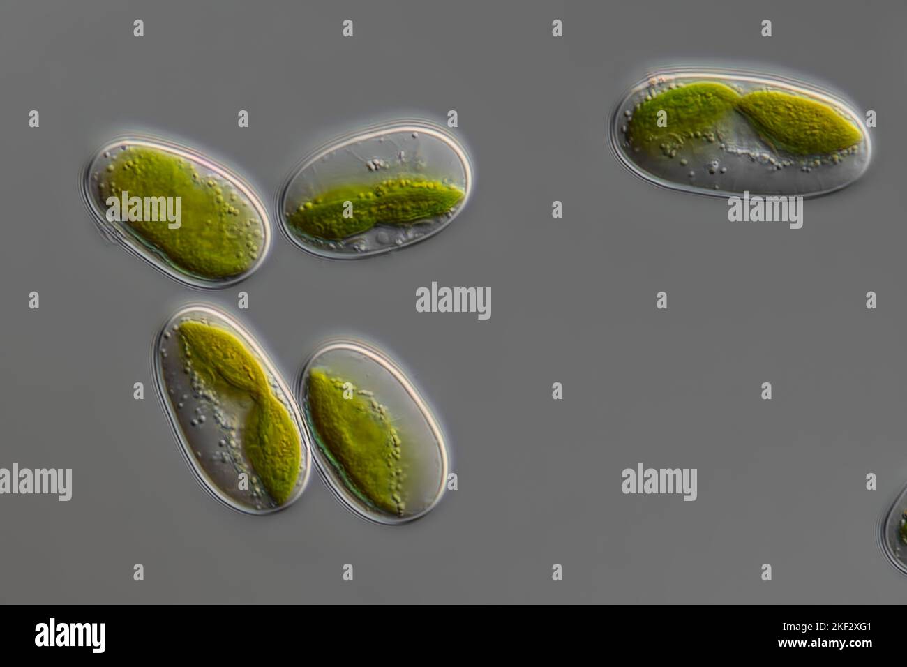 Mesotaenium chlamydosporum algae, light micrograph Stock Photo - Alamy