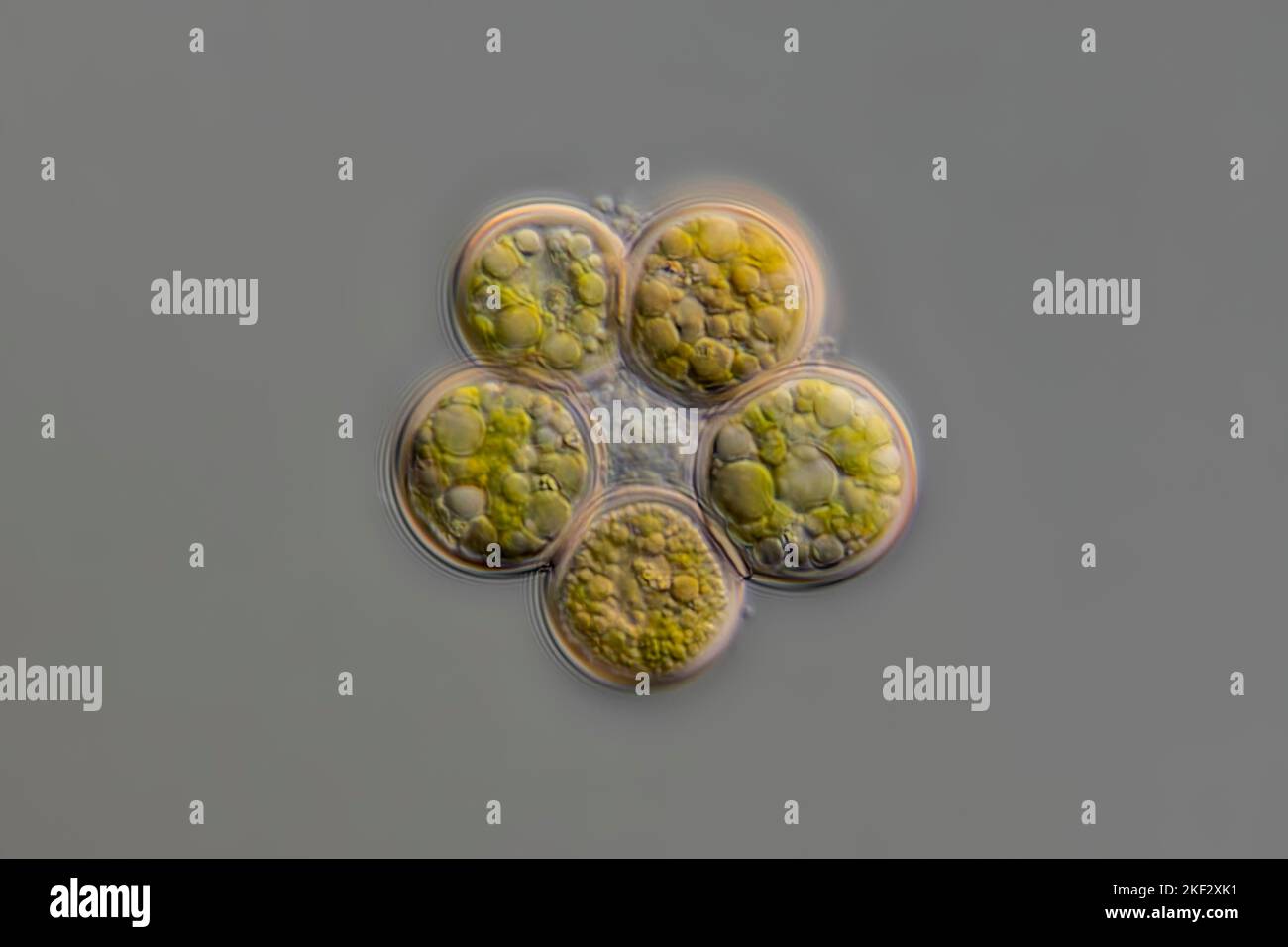 Coenochloris fottii cf. algae, light micrograph Stock Photo - Alamy