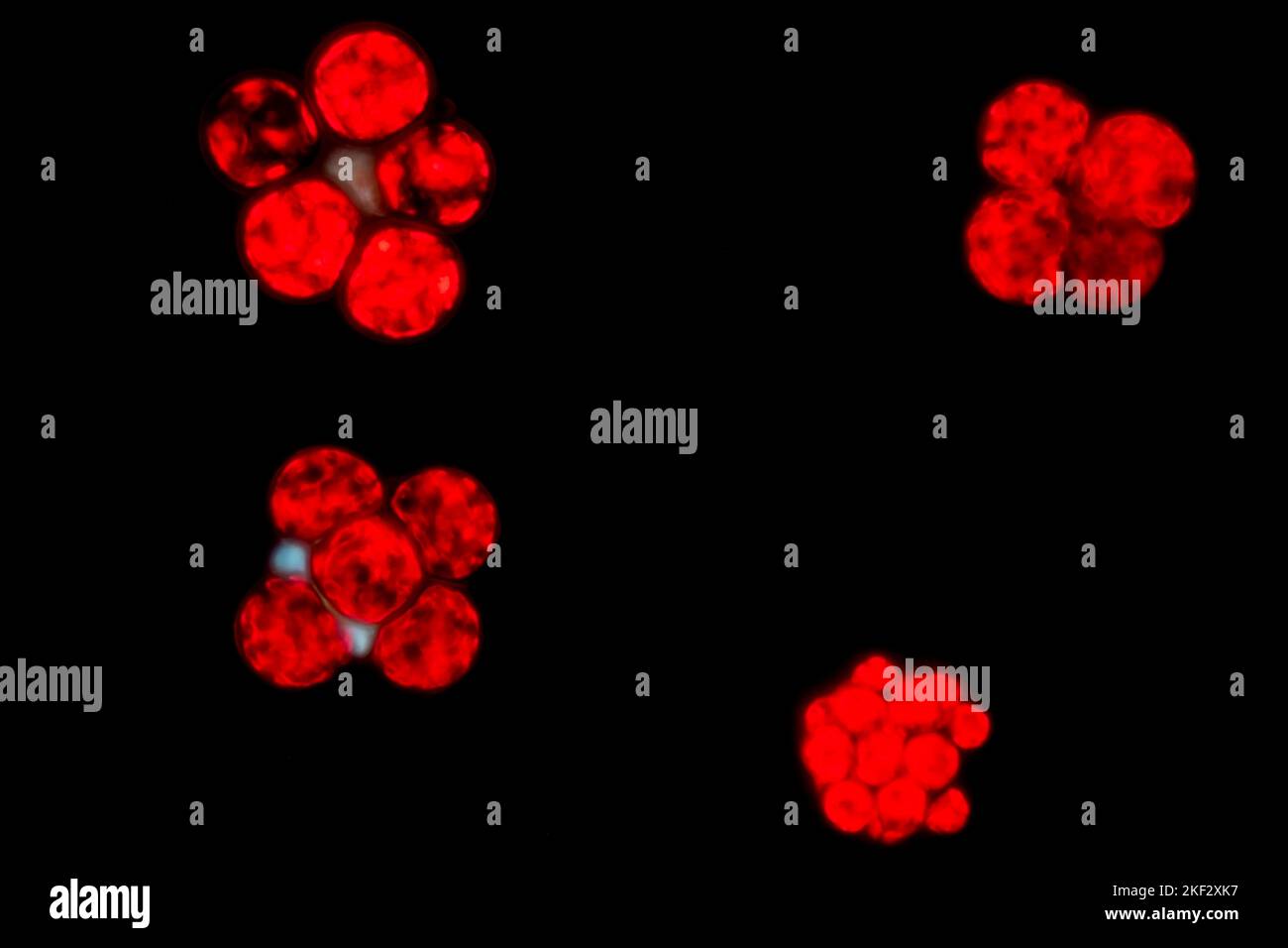 Coenochloris fottii cf. algae, light micrograph Stock Photo - Alamy