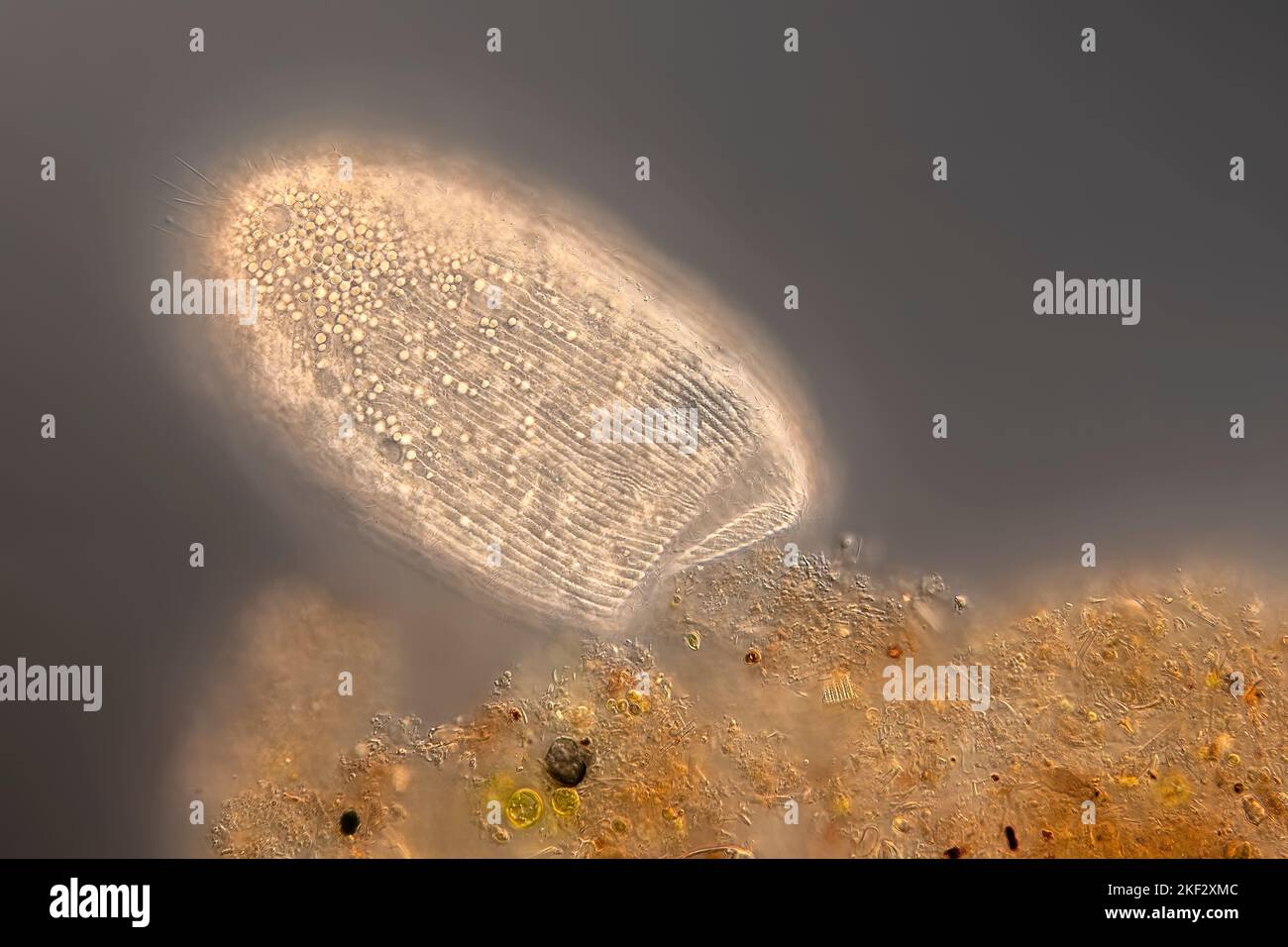 Prorodon sp., light micrograph Stock Photo - Alamy