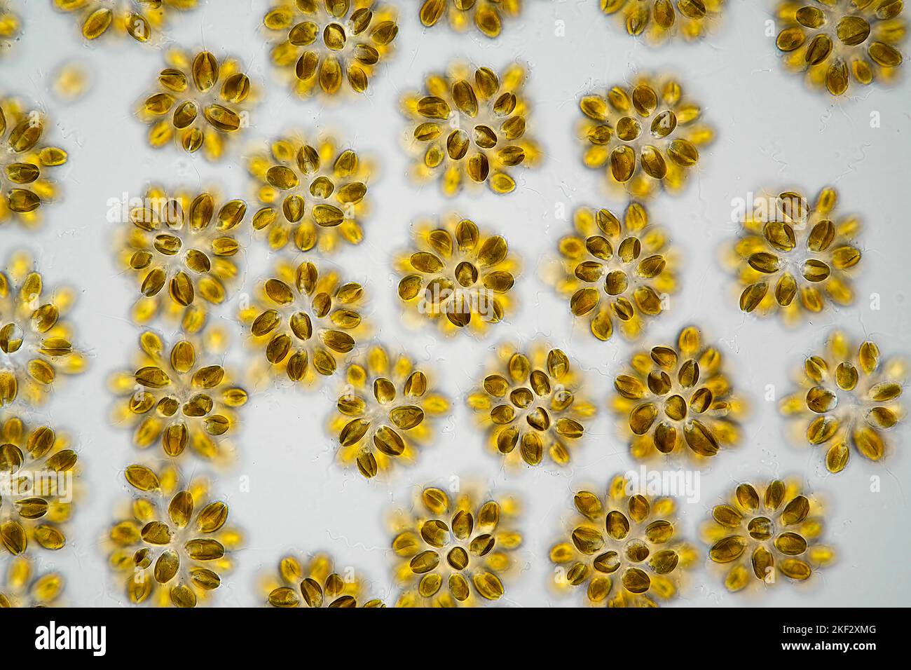 Synura sp. algae, light micrograph Stock Photo - Alamy