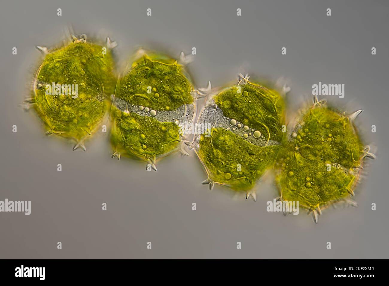 Xanthidium armatum algae, light micrograph Stock Photo - Alamy