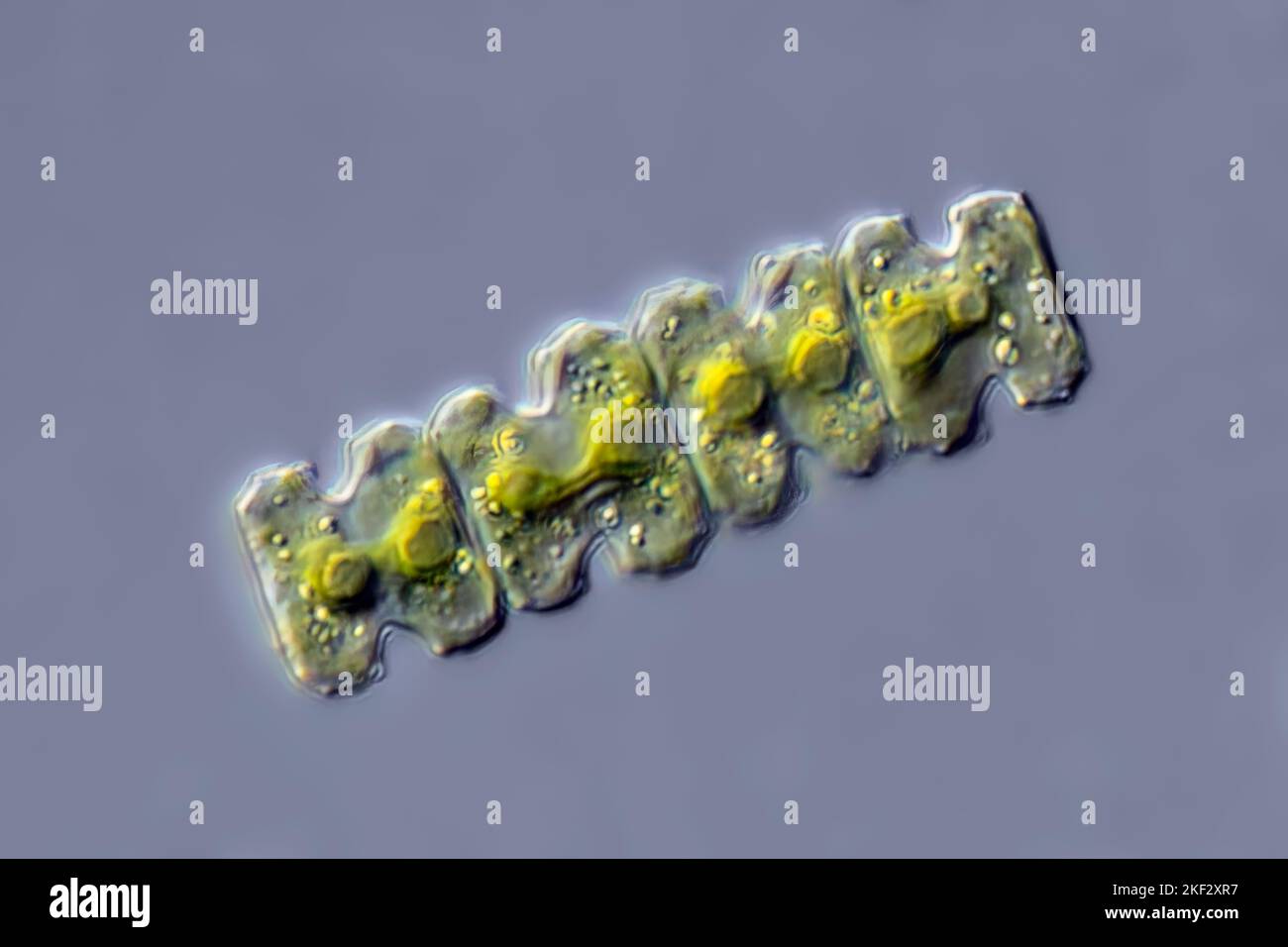 Teilingia granulata algae, light micrograph Stock Photo - Alamy