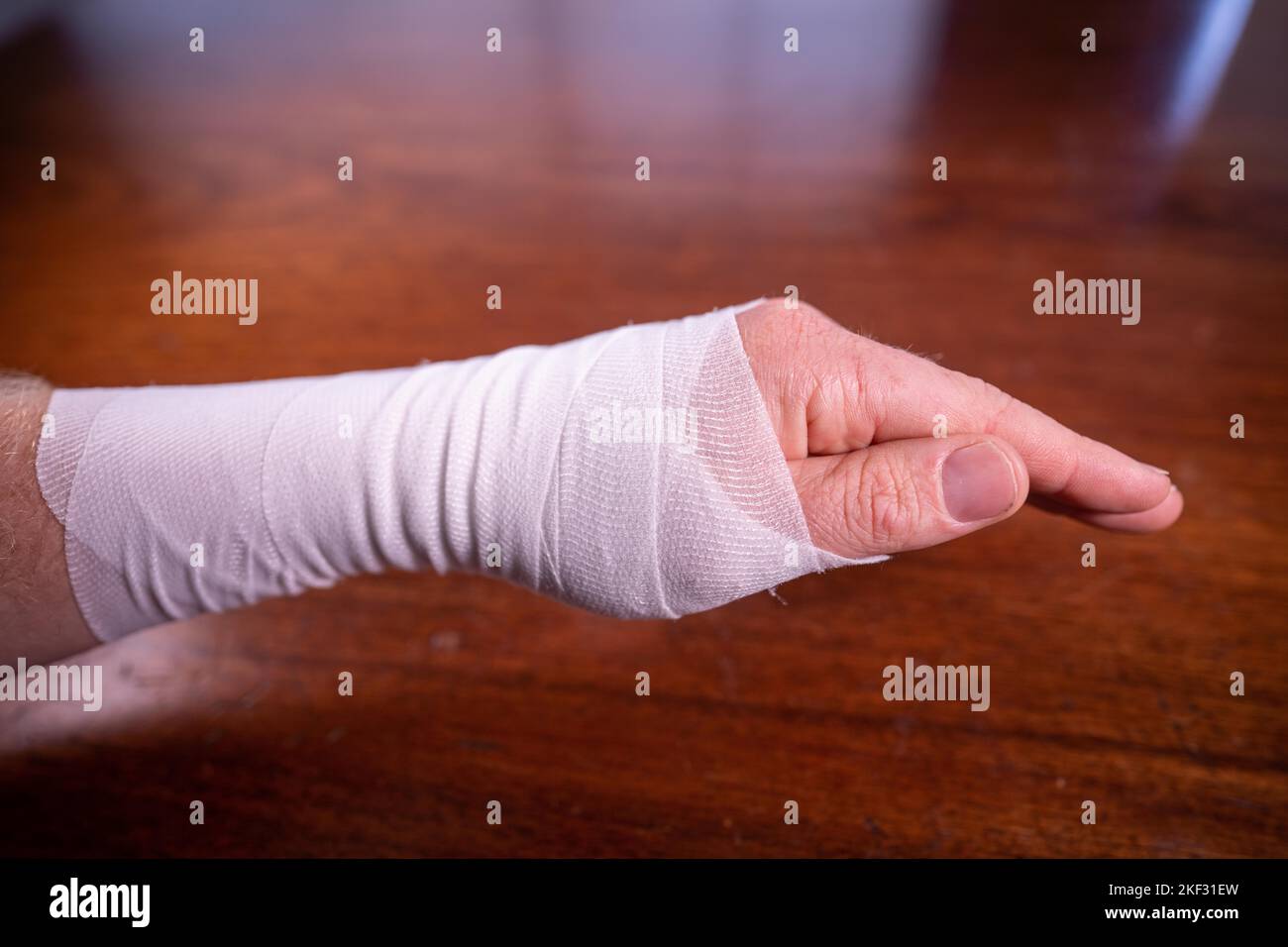 bandaging an arm of a patient in a hospital in care Stock Photo - Alamy