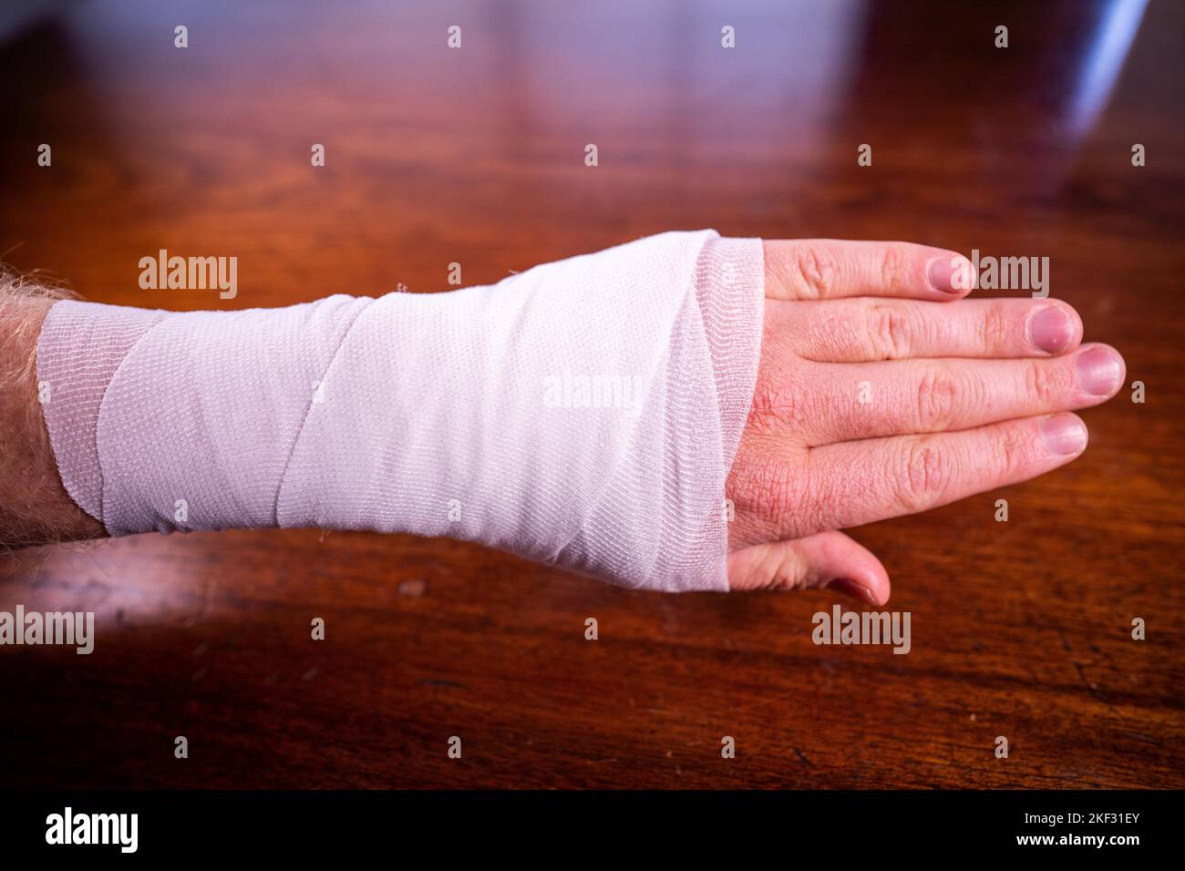 Woman with broken arm home hi-res stock photography and images - Alamy