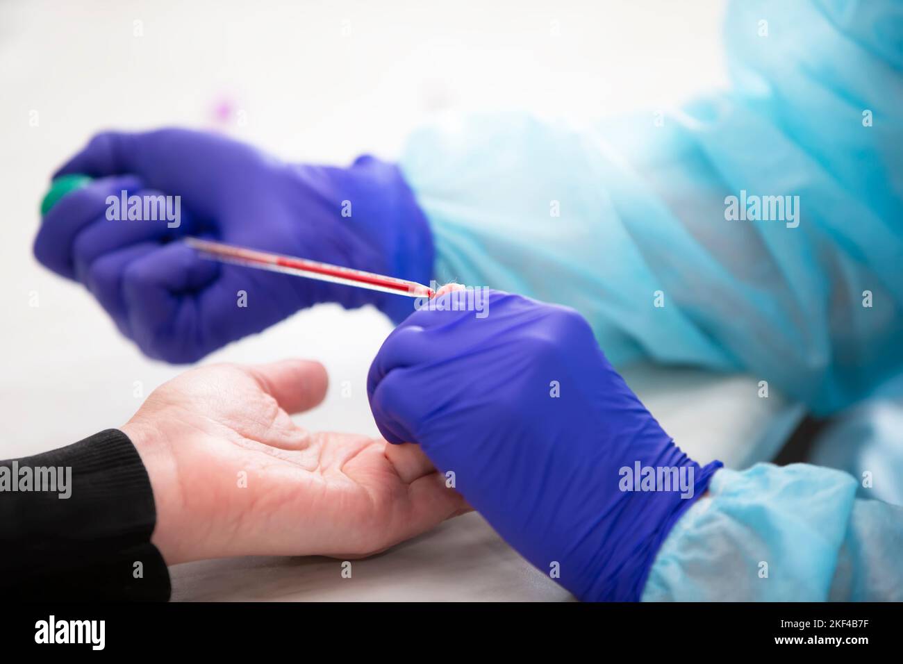 Taking blood for a general analysis, a clinical blood test. Collection ...