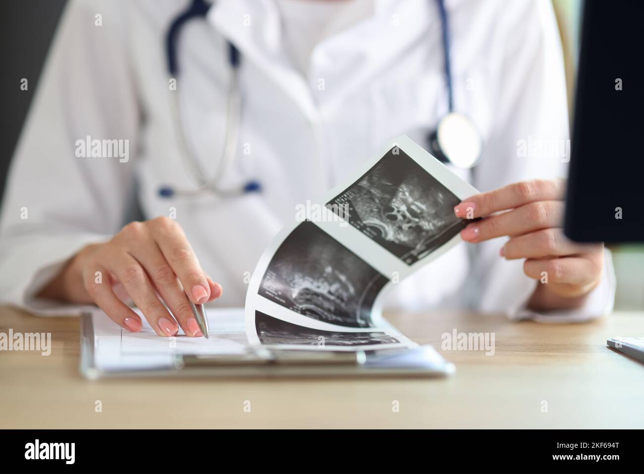 Female doctor with stethoscope doing paperwork, checking medical ...