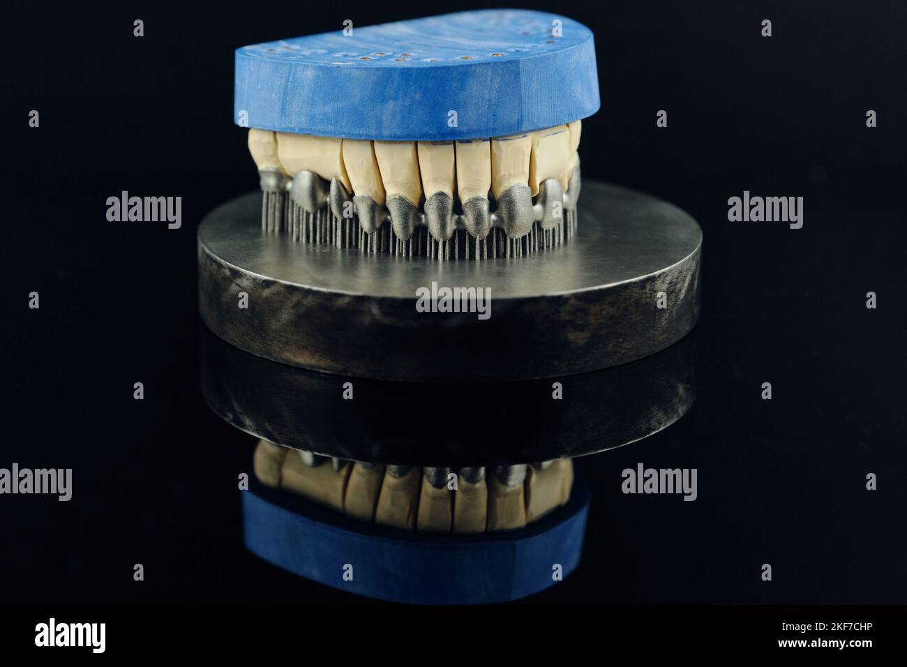 Tooth dental crowns created on 3d printer for metal. Gypsum model on a ...