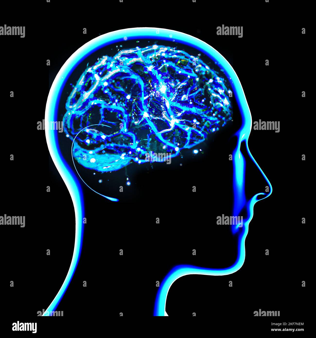 Section of a brain seen in profile. Degenerative diseases, Parkinson ...