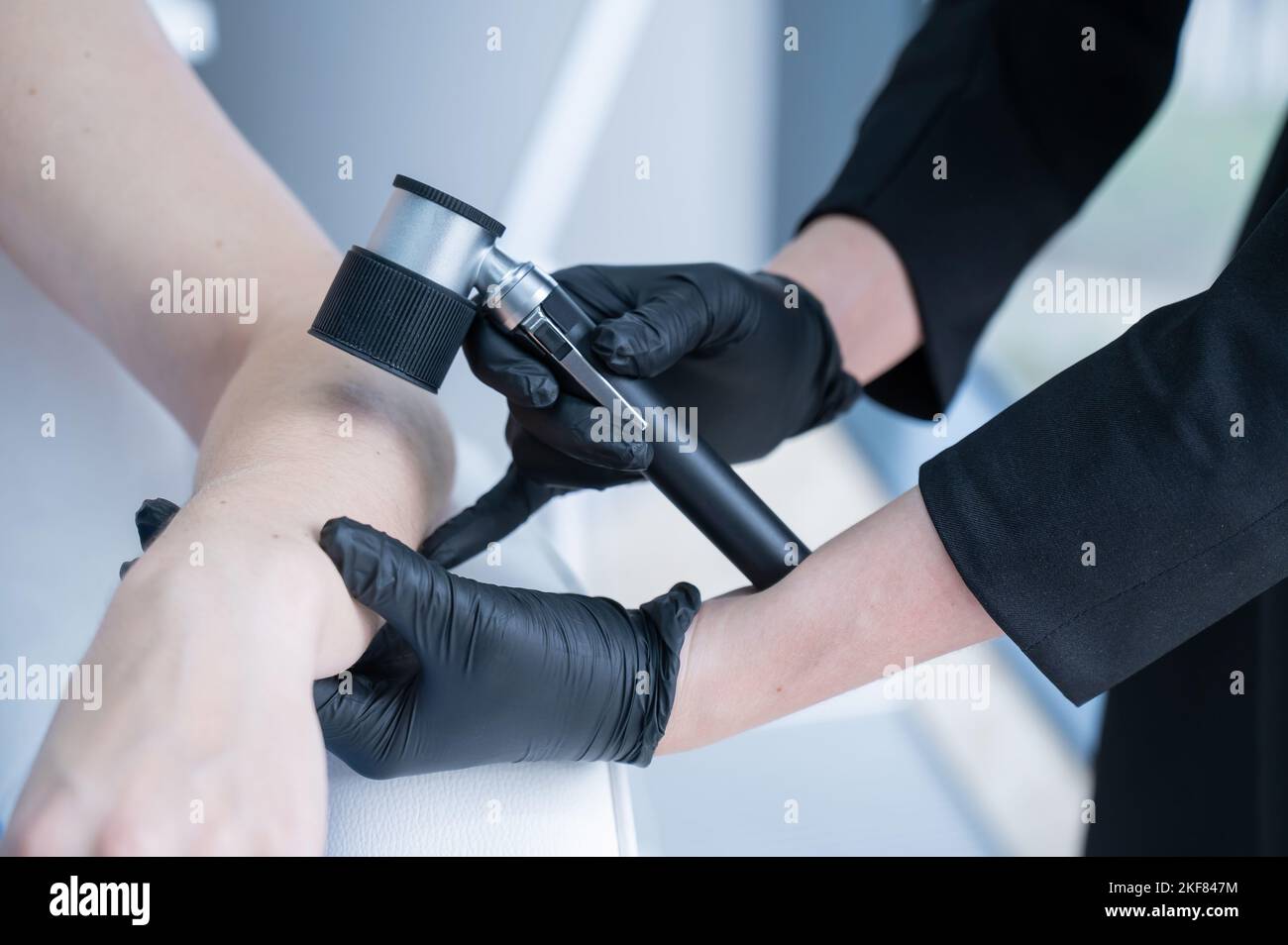 A dermatologist examines a patient's mole through a dermatoscope Stock ...