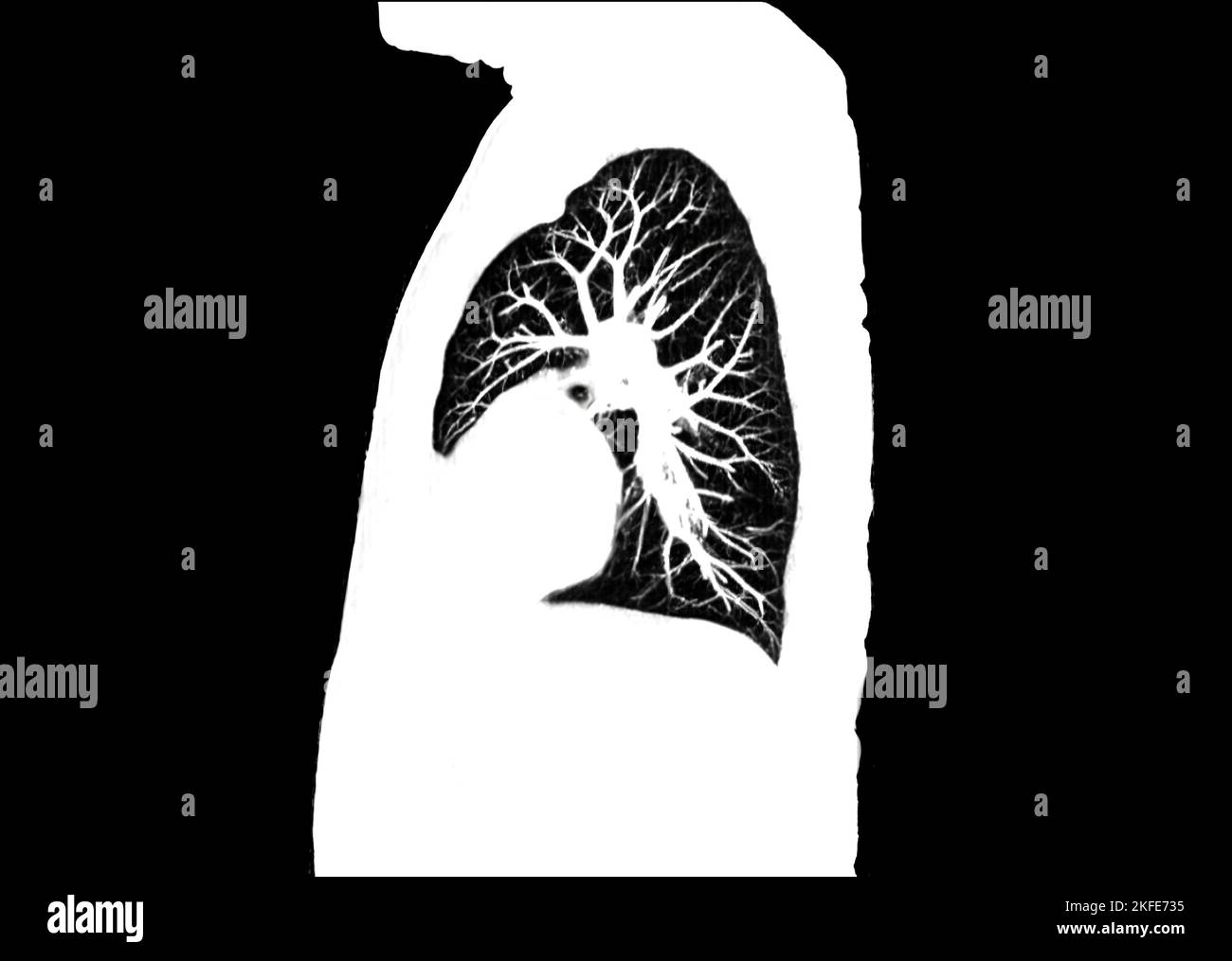 Ct scan of chest hi-res stock photography and images - Alamy
