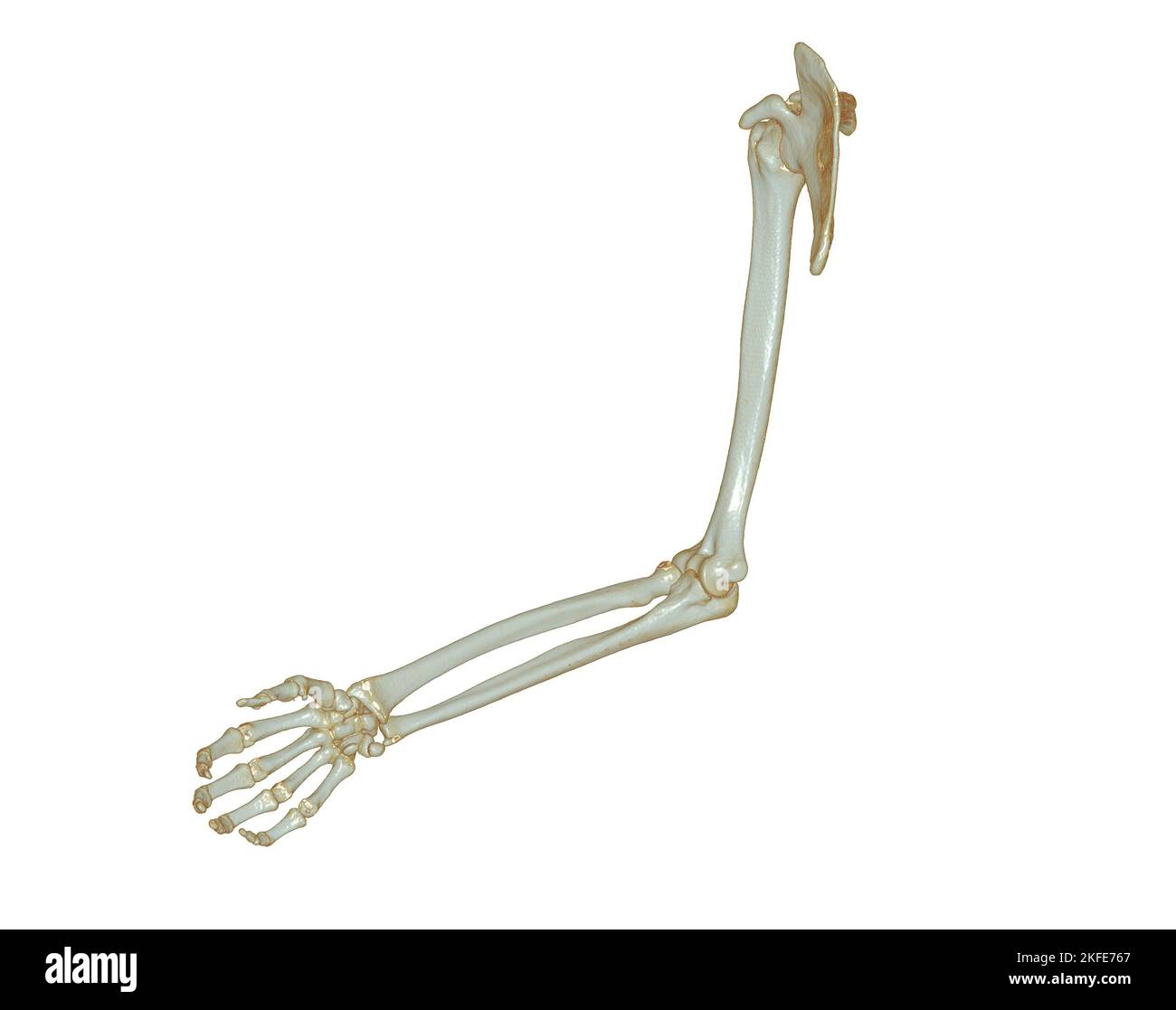 CT SCAN of Upper extremity 3D rendering isolated on white background ...