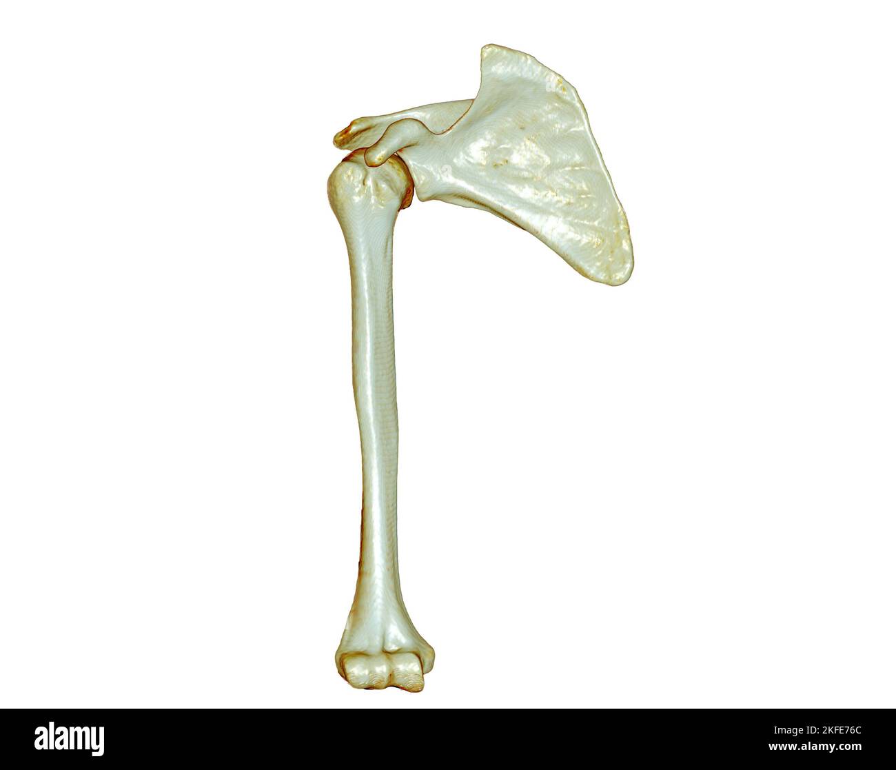 CT SCAN of Arm 3D rendering isolated on white background .Clipping path ...