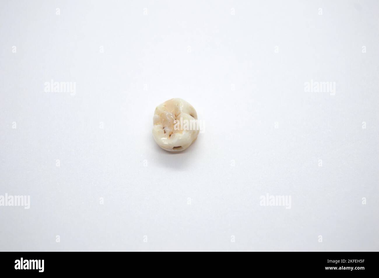 Baby milk teeth isolated on white background Stock Photo - Alamy