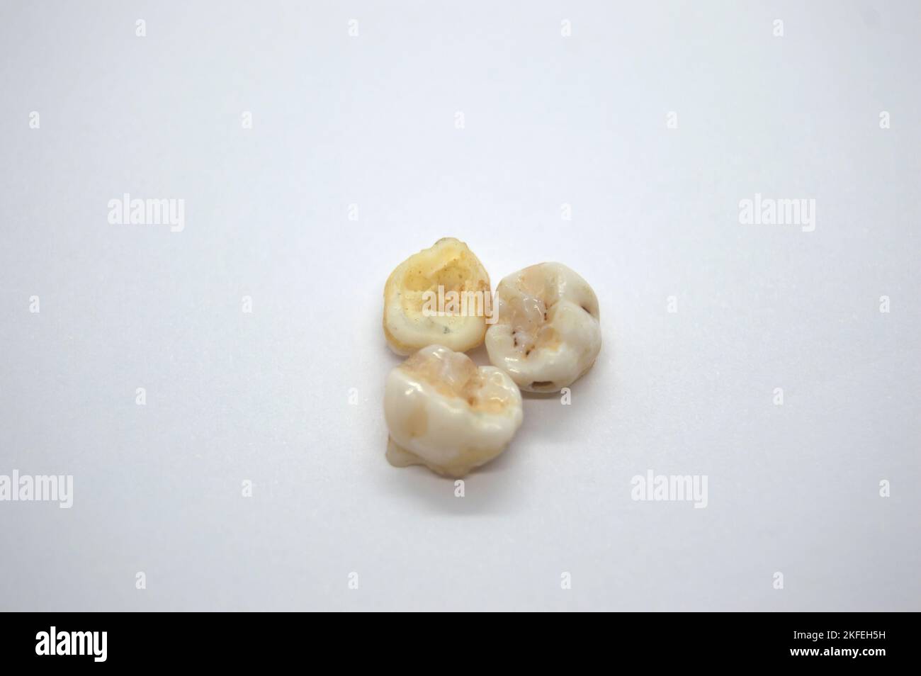 Baby milk teeth isolated on white background Stock Photo - Alamy