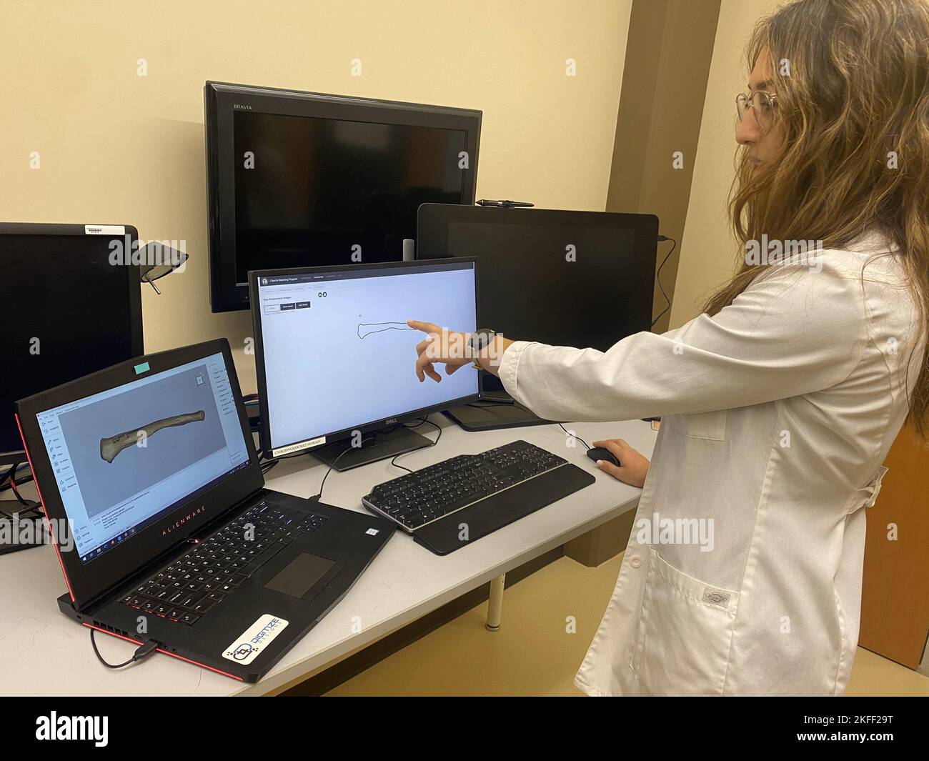 The Clavicle Matching Program (CMP) is a computer program that compares ...