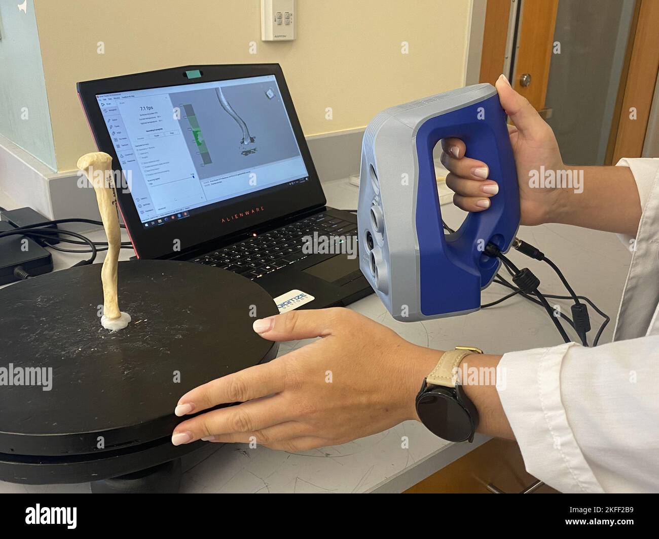 The Clavicle Matching Program (CMP) is a computer program that compares ...