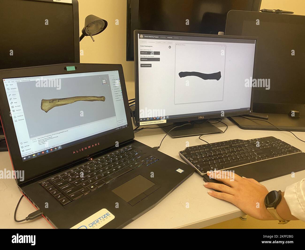 The Clavicle Matching Program (CMP) is a computer program that compares ...