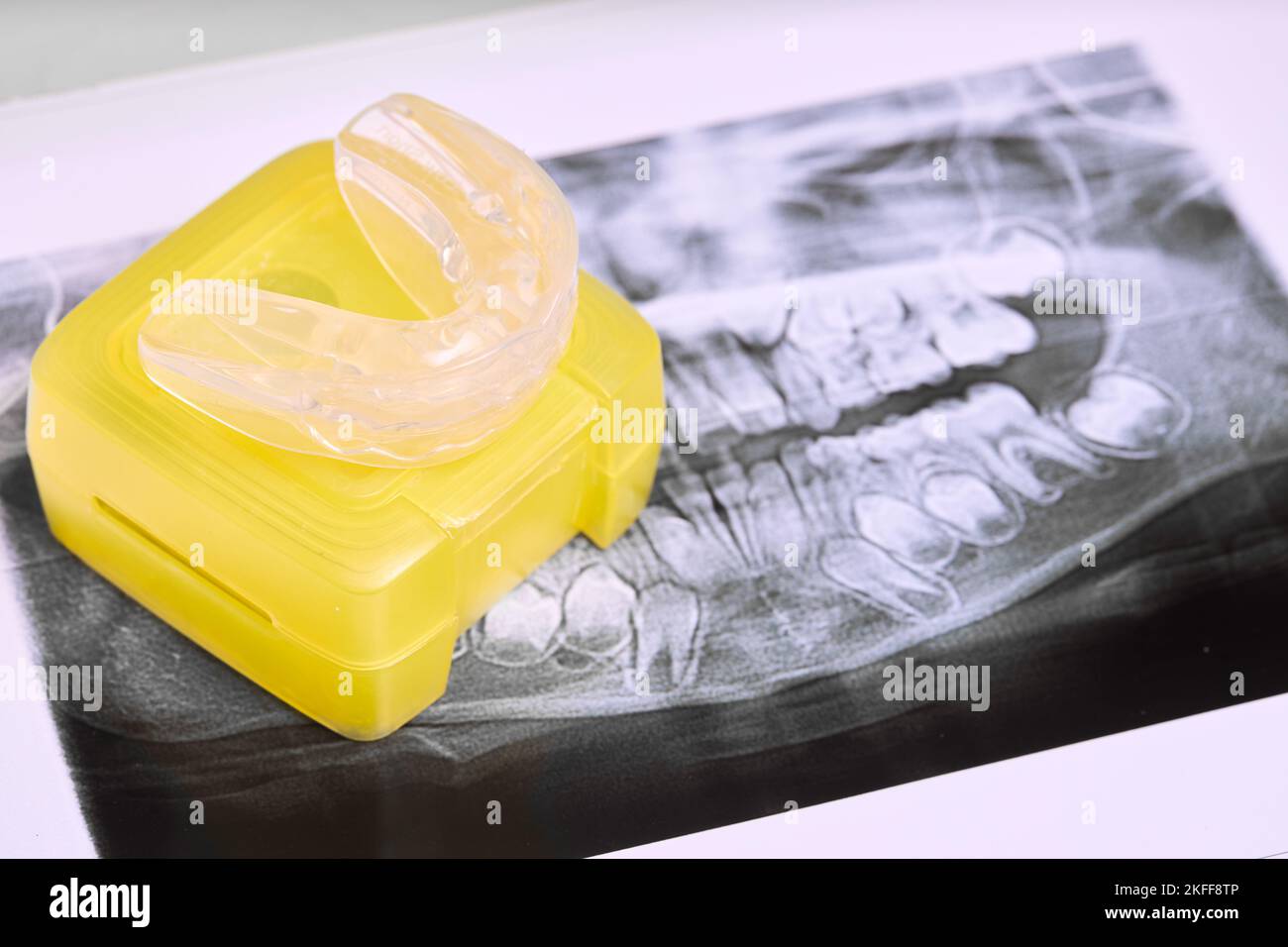 Set of individual activator and aligner for orthodontic treatment ...