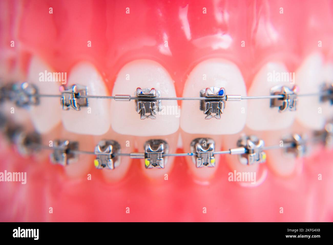 macro photography shows how the braces are arranged Stock Photo - Alamy