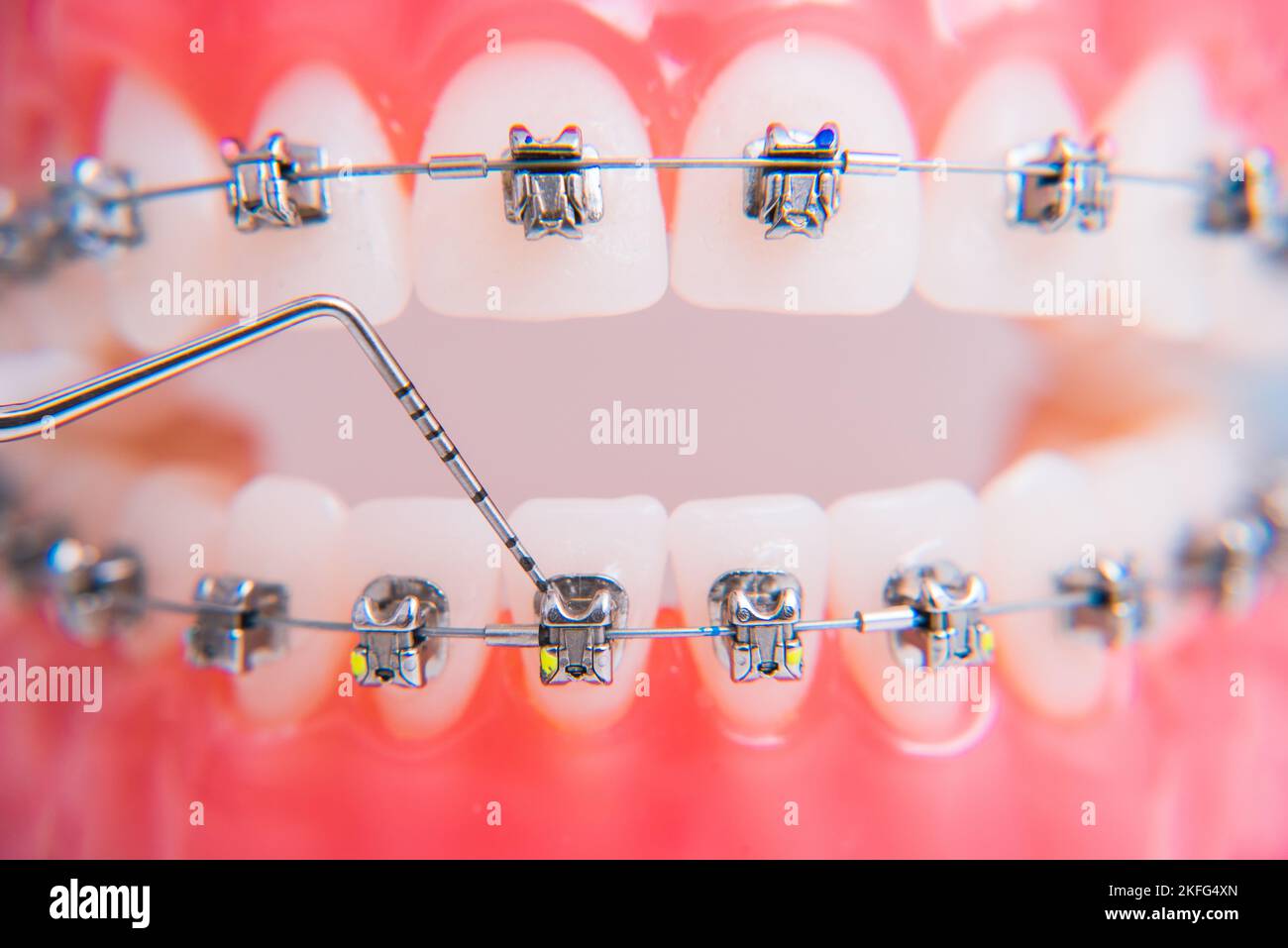macro photography shows how the braces are arranged Stock Photo - Alamy