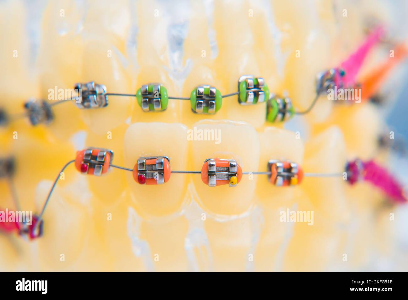 macro photography shows how the braces are arranged Stock Photo - Alamy