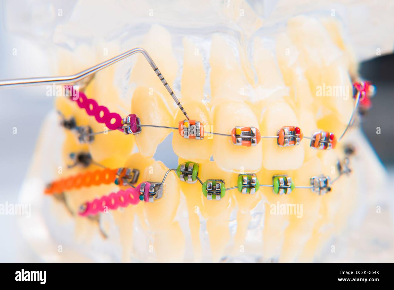 macro photography shows how the braces are arranged Stock Photo - Alamy