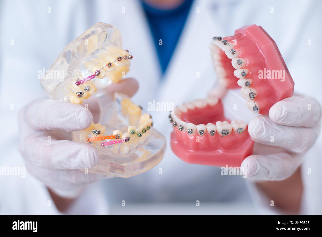 the doctor shows how the system of braces on teeth is arranged Stock ...