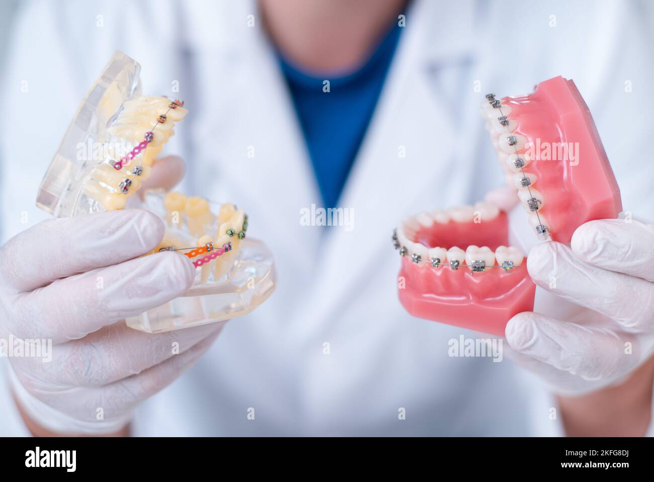 the doctor shows how the system of braces on teeth is arranged Stock Photo - Alamy
