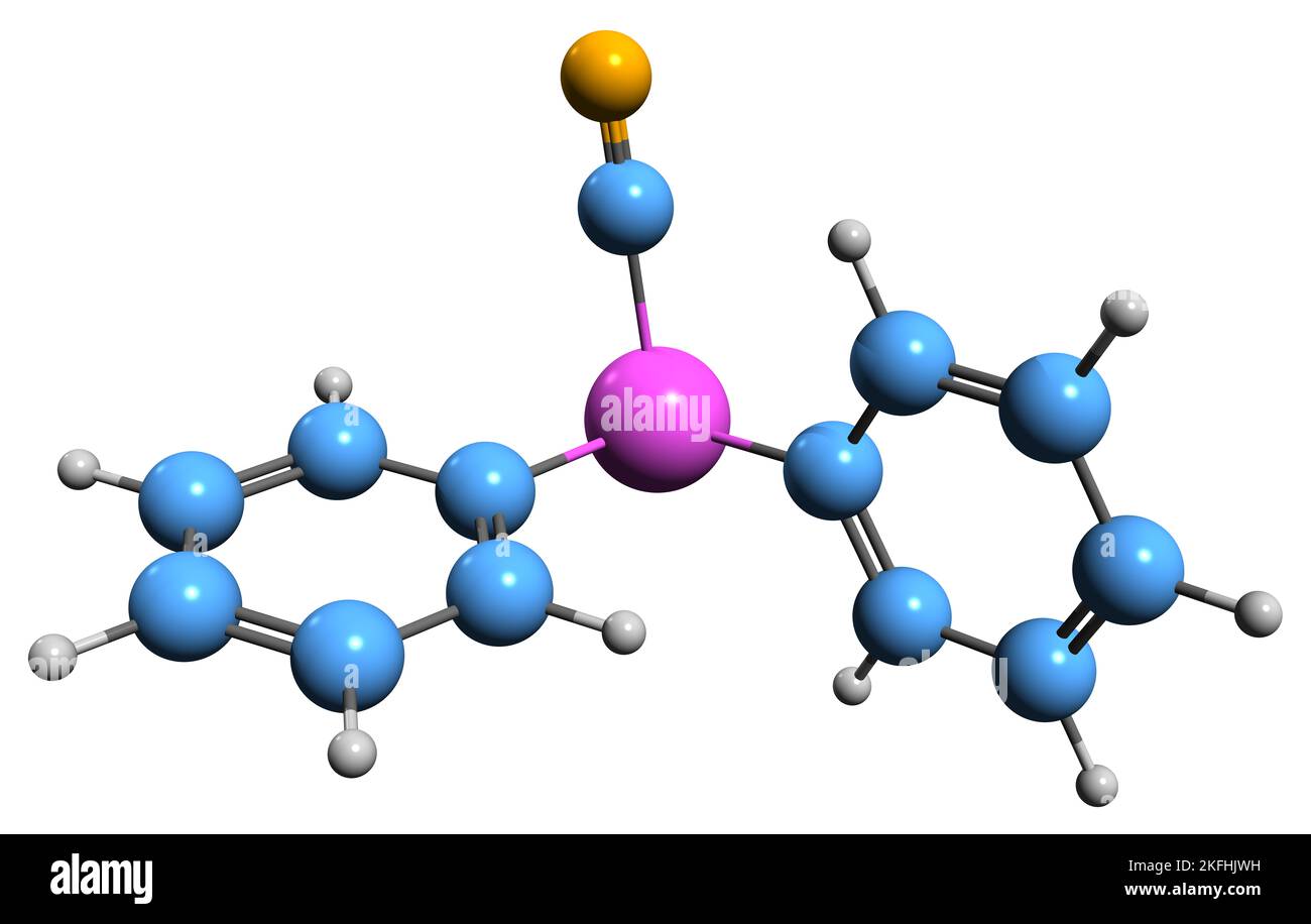 Acute pulmonary edema Cut Out Stock Images & Pictures - Alamy