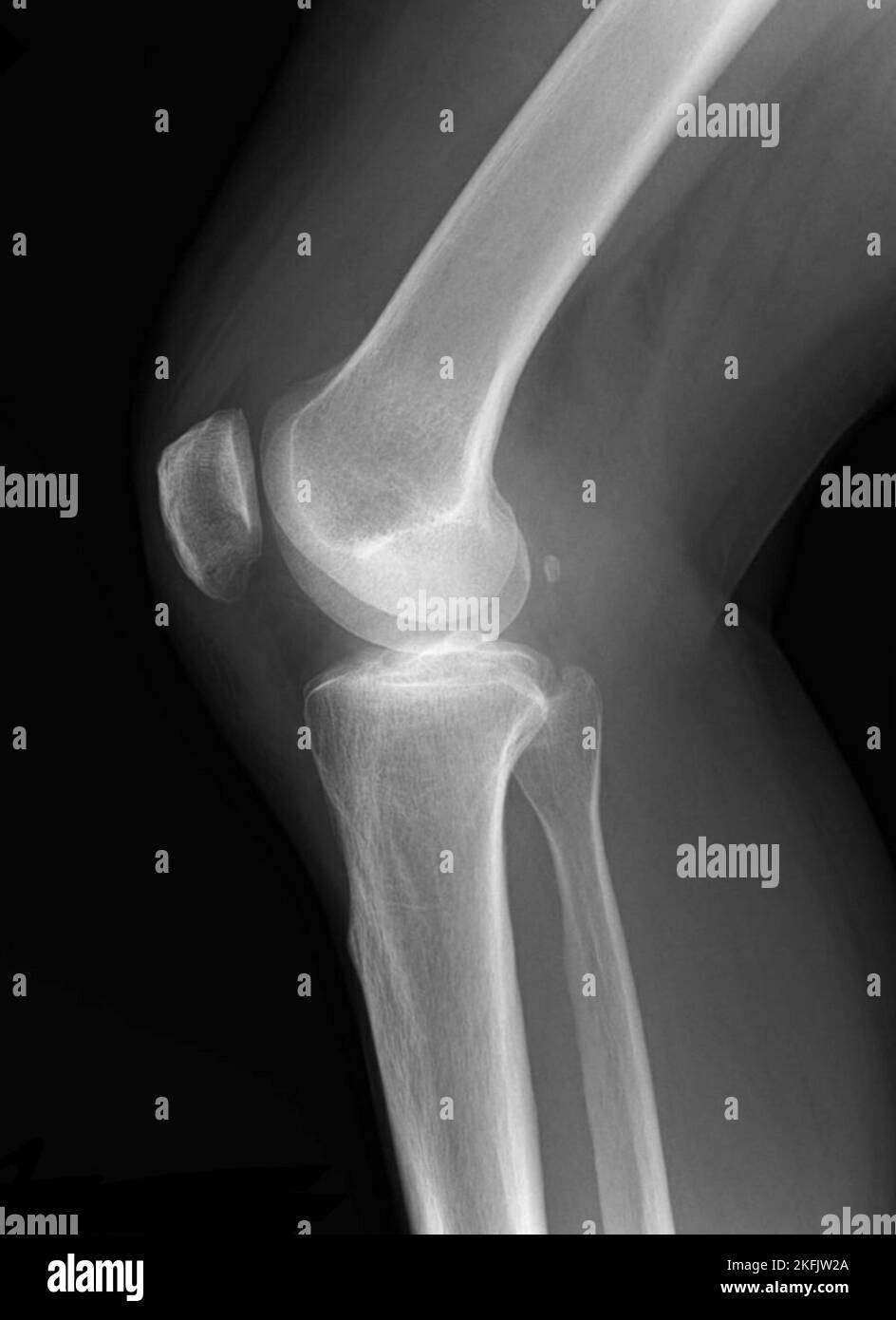 The human knee in the profile of a knee hi-res stock photography and ...
