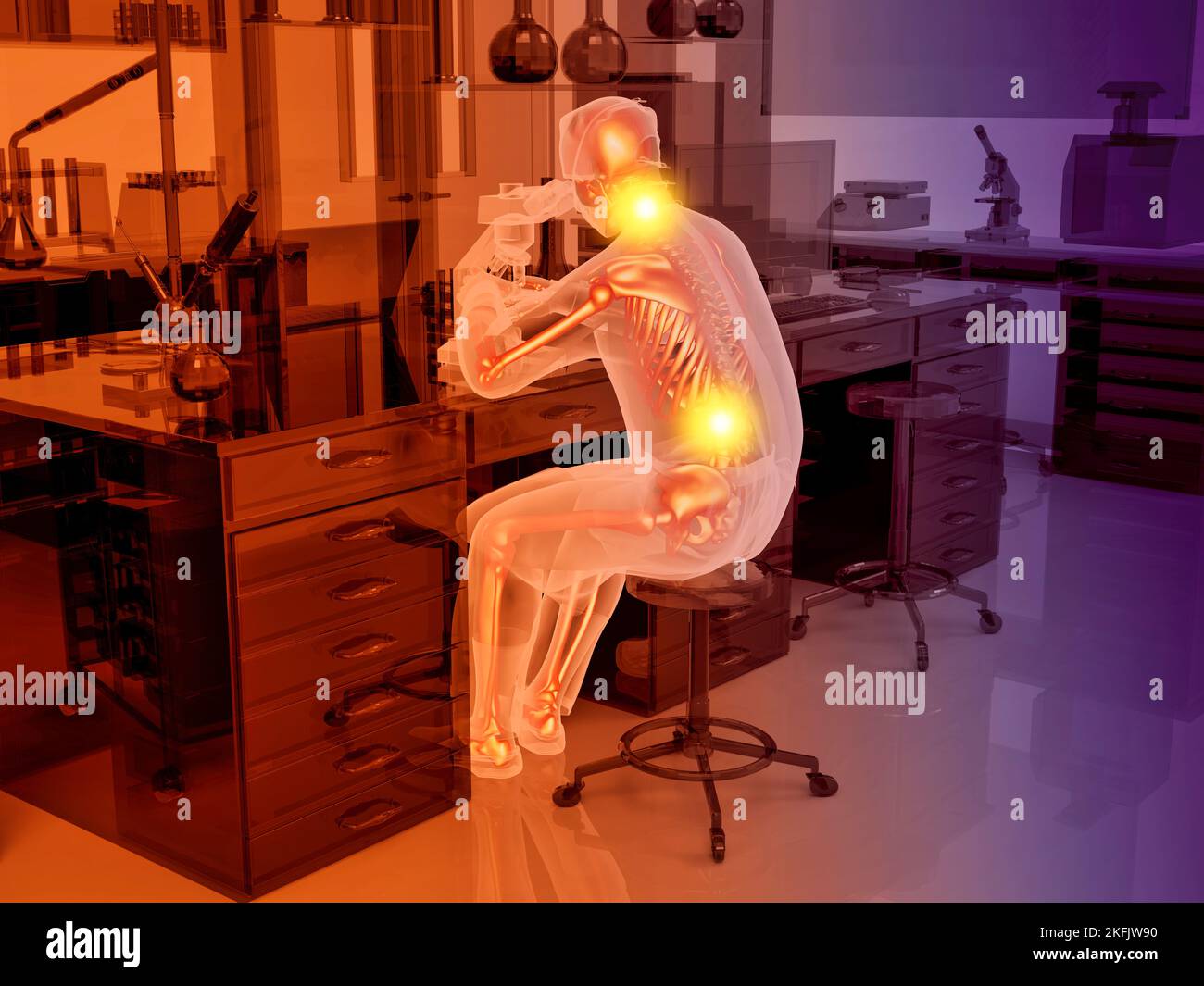 Musculoskeletal disorders in laboratory workers, illustration Stock ...