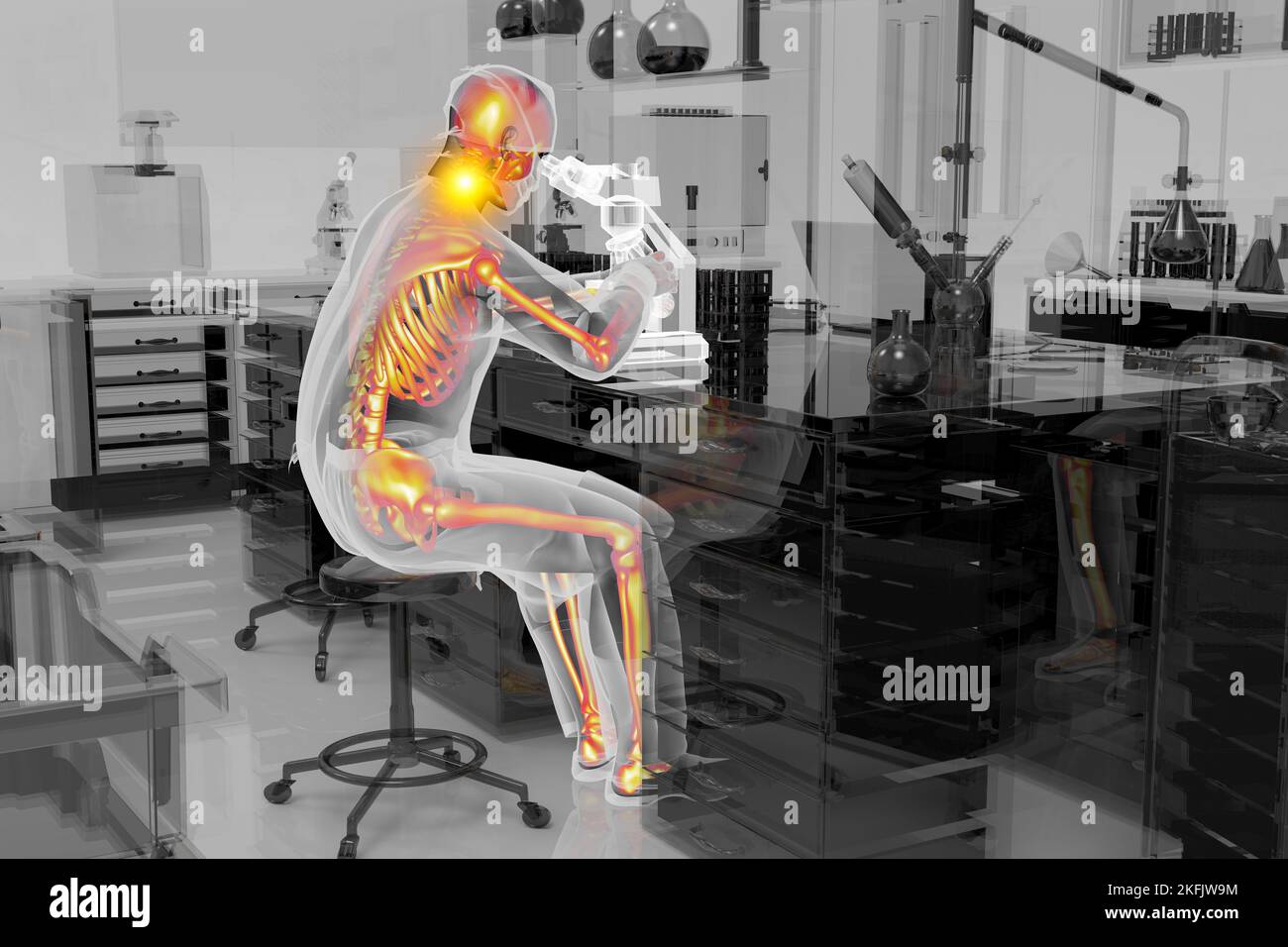 Musculoskeletal disorders in laboratory workers, illustration Stock ...