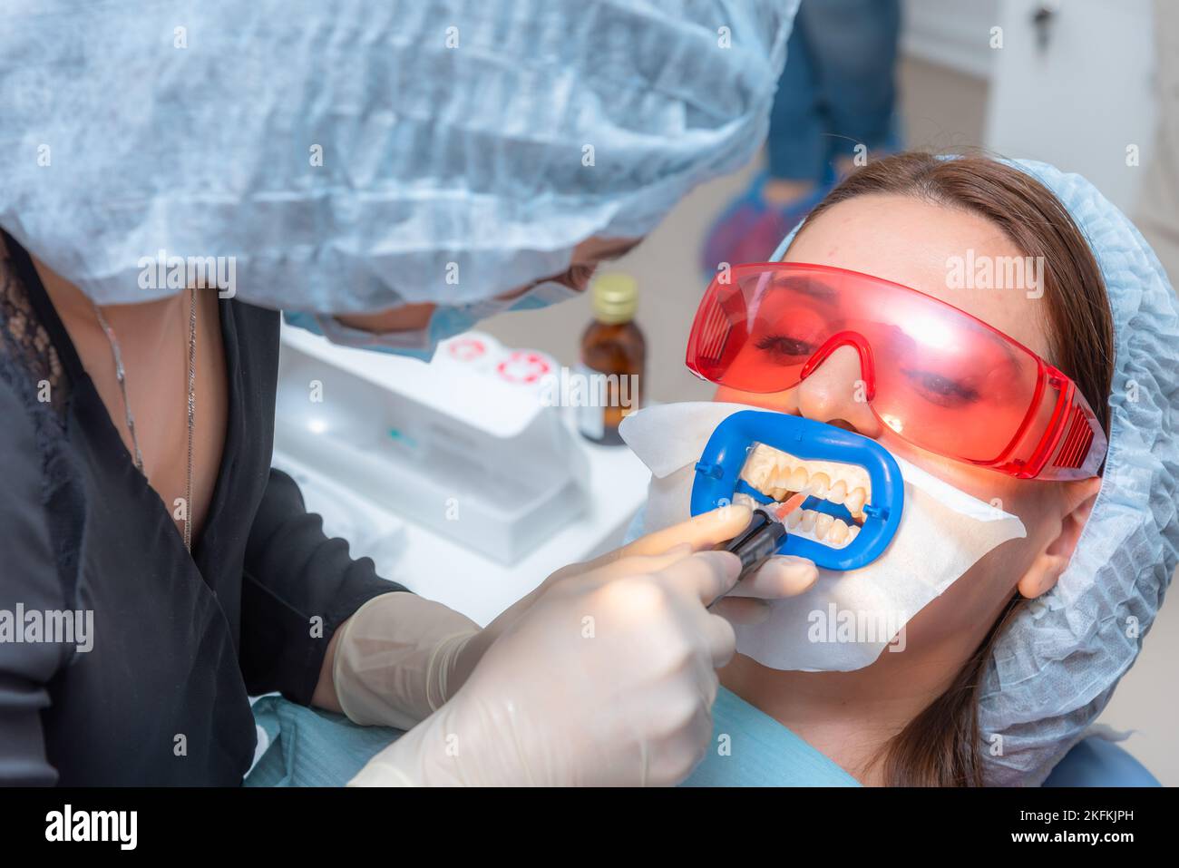 there is a preparation of the oral cavity to bleaching with the help of ...