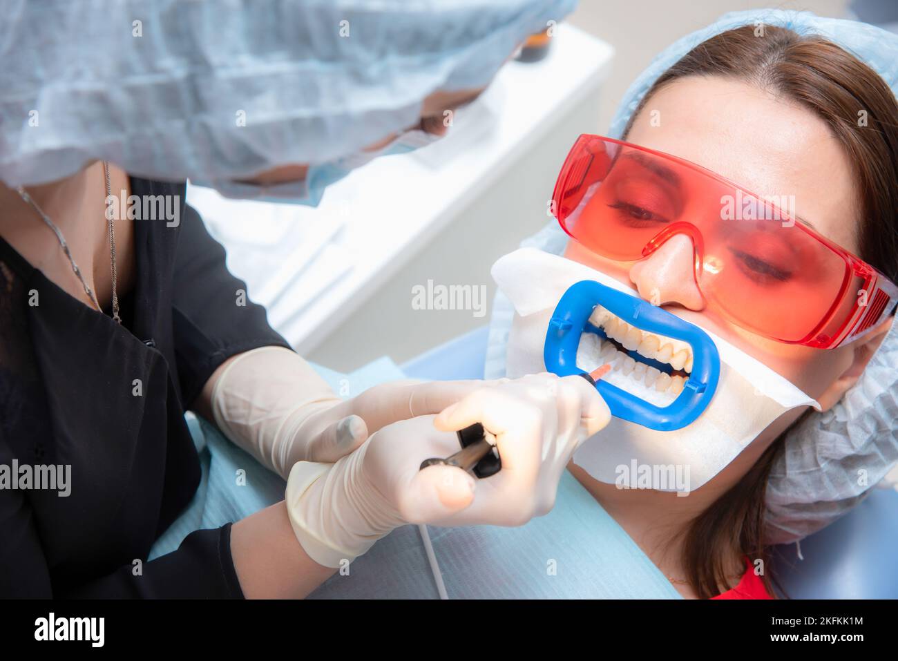 there is a preparation of the oral cavity to bleaching with the help of ...