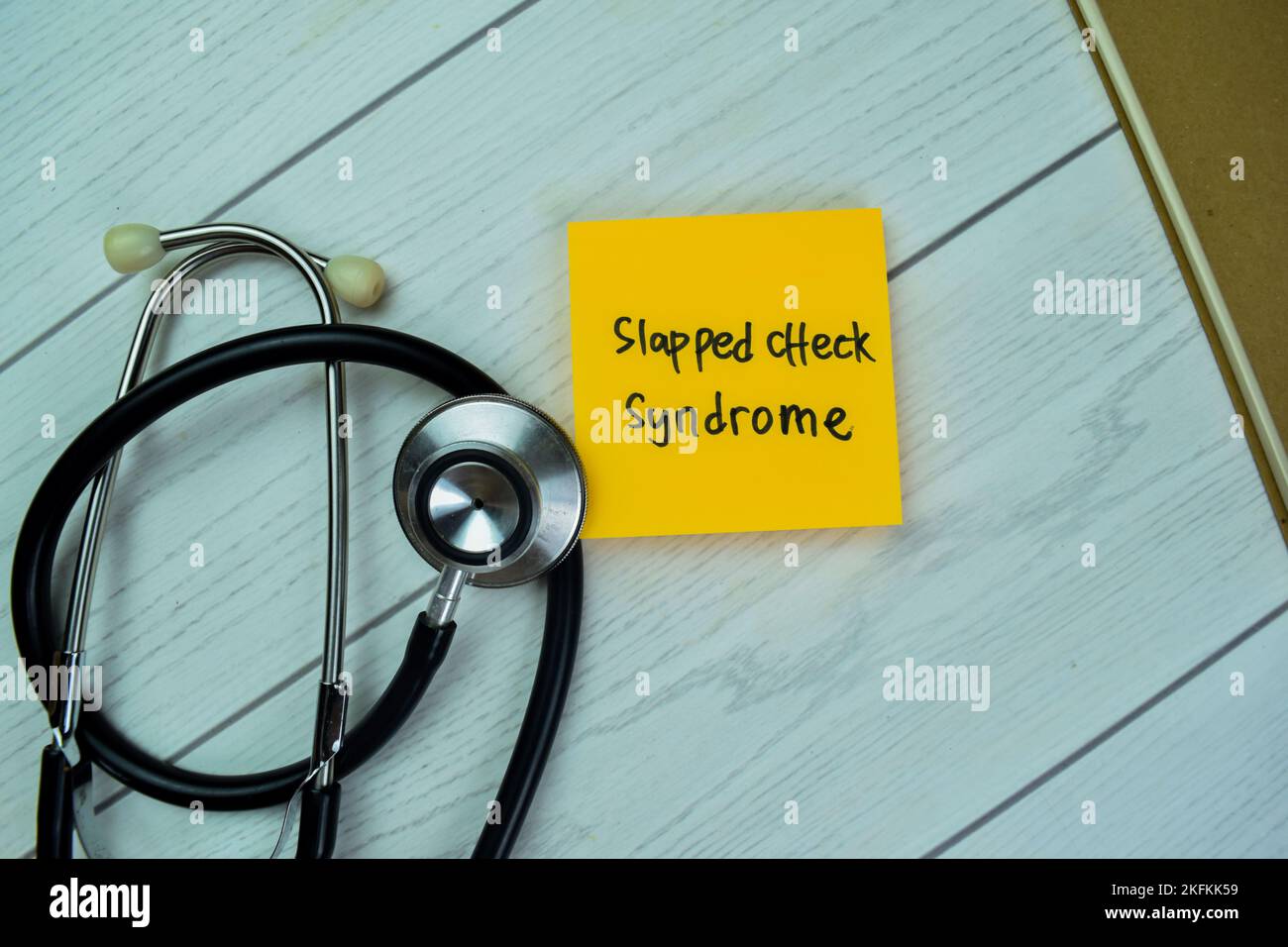 Concept of Slapped Check Syndrome write on sticky notes isolated on ...