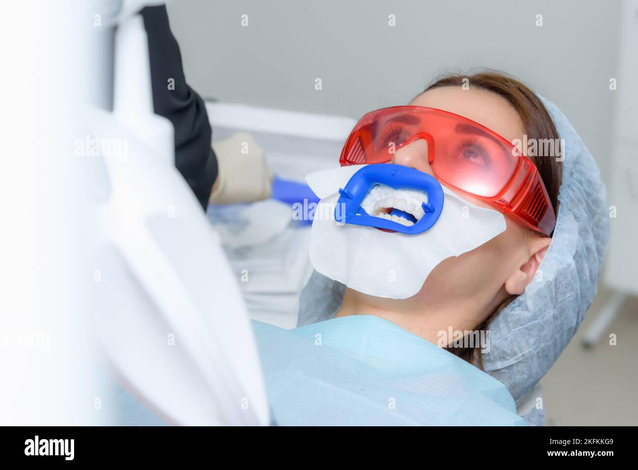 there is a preparation of the oral cavity to bleaching with the help of ...