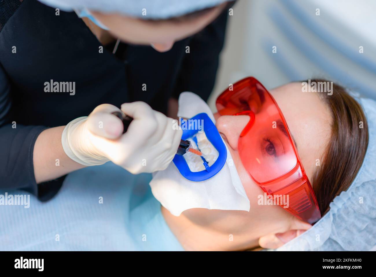 there is a preparation of the oral cavity to bleaching with the help of ...