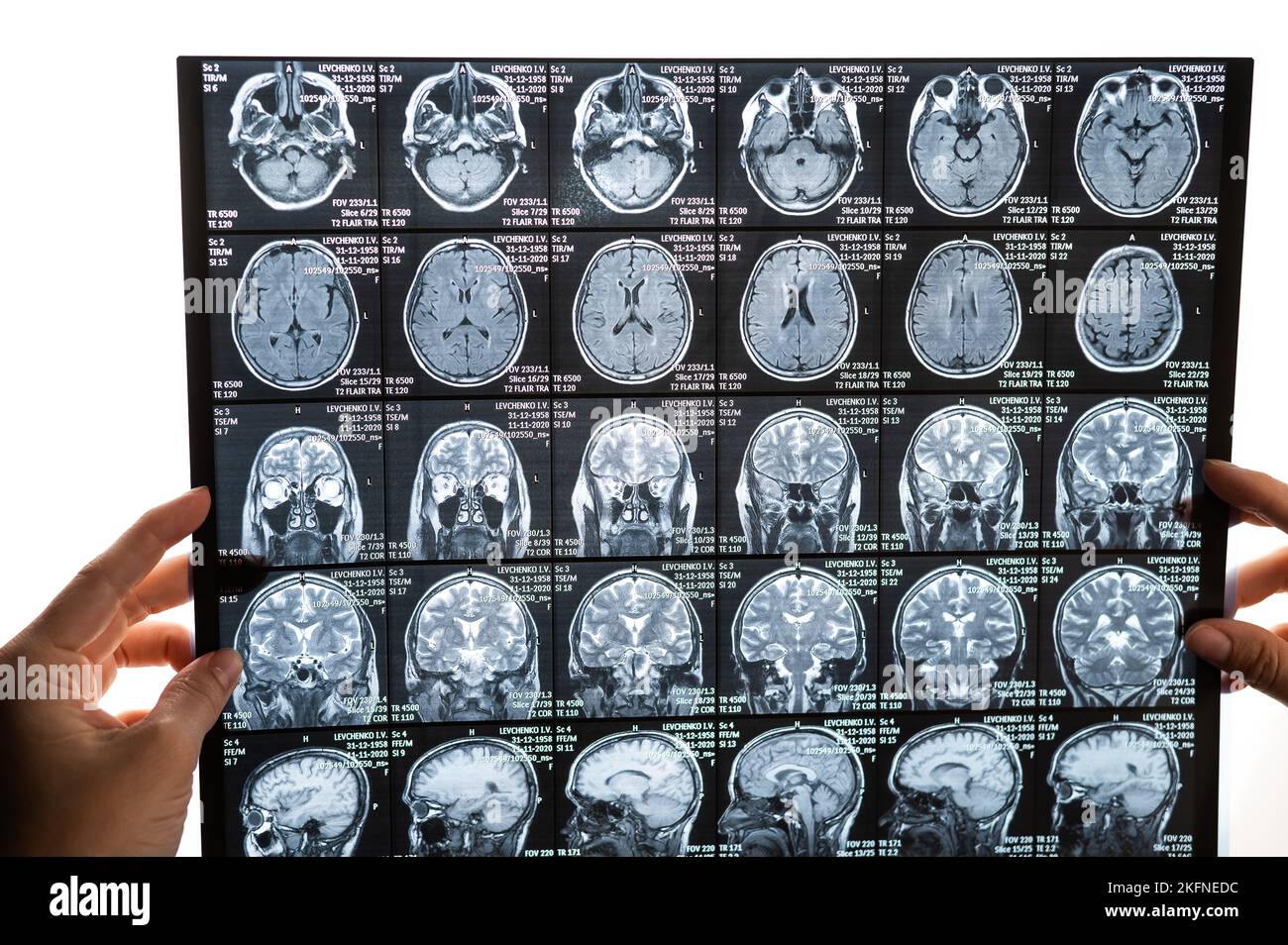 Woman doctor examines head hi-res stock photography and images - Alamy